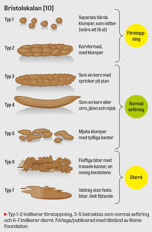 IBS – irritabel tarm – Läkartidningen